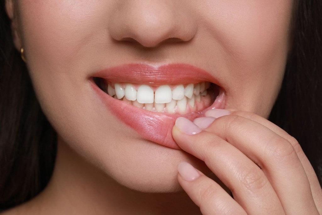 Boost Your Confidence with Gum Grafting Procedures at Sound Surgical ...