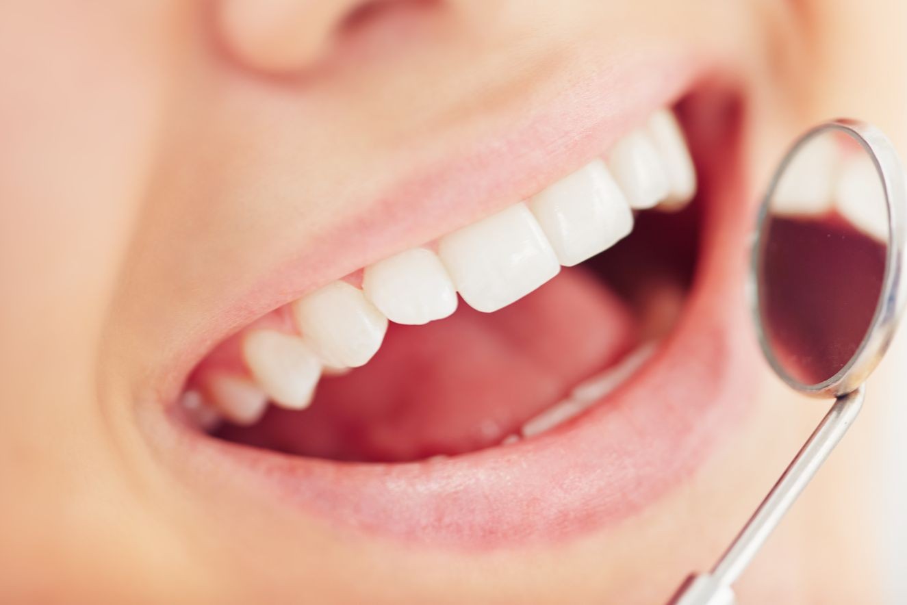 Teeth In An Hour™ at Sound Surgical Arts: Transform Your Smile Faster ...